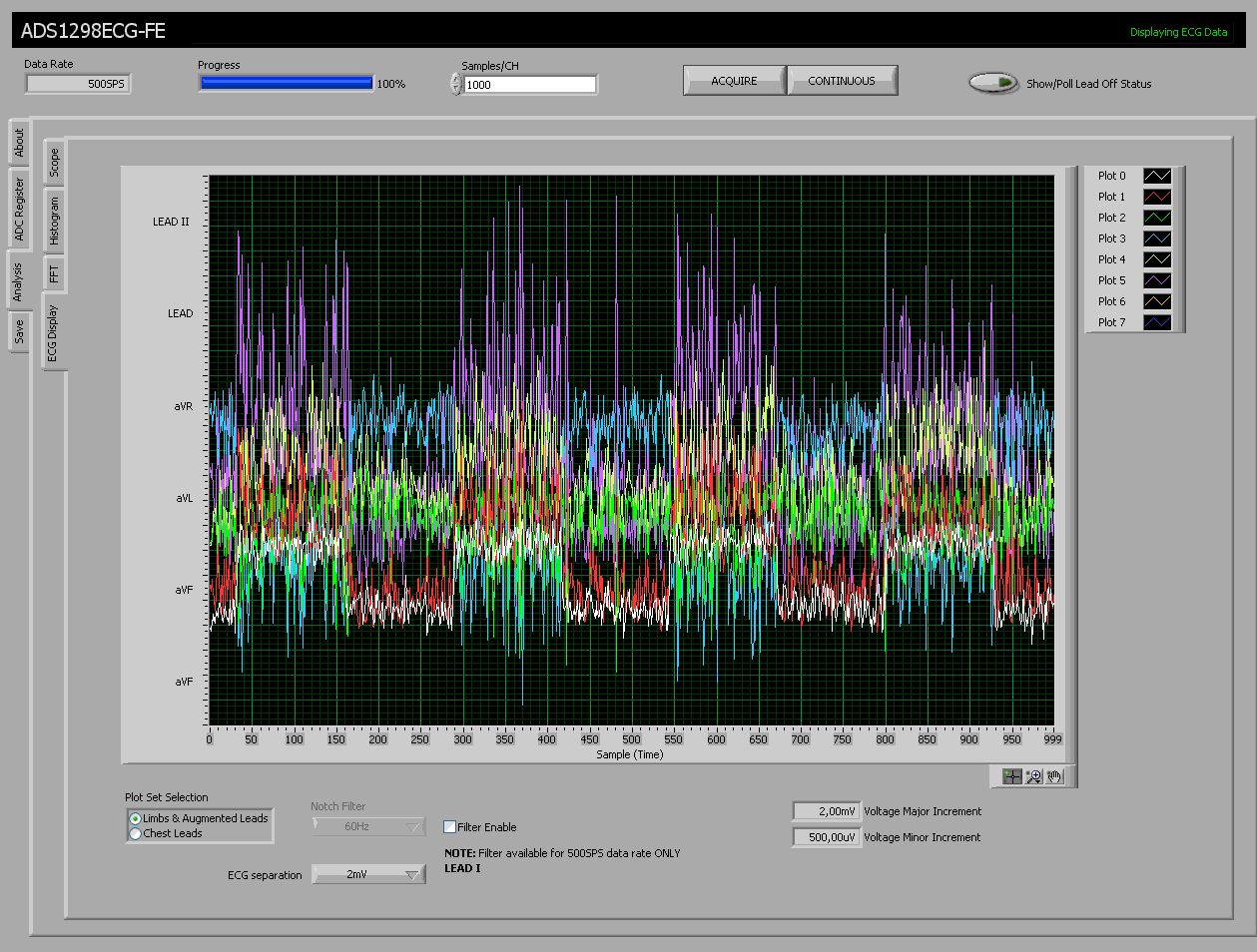 Ads1298evm Noise Problem Data Converters Forum Data Converters Ti E2e Support Forums