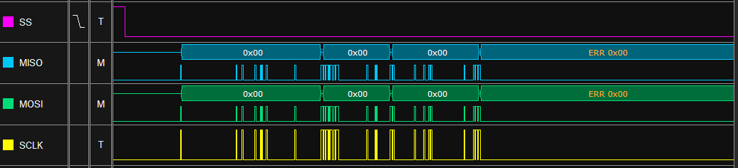 Lmp90100 Spi Interface Data Converters Forum Data Converters Ti E2e Support Forums