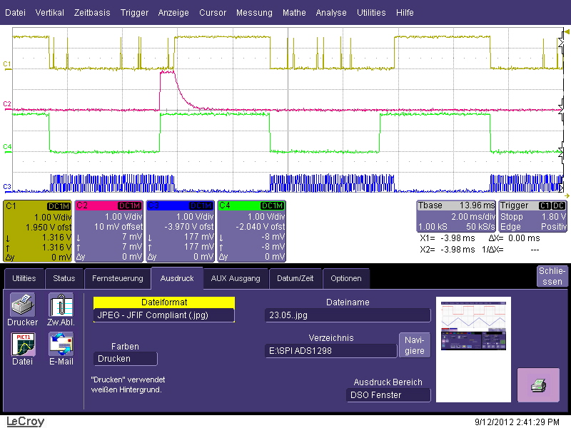 Ads1298 Drdy Signal Data Converters Forum Data Converters Ti E2e Support Forums