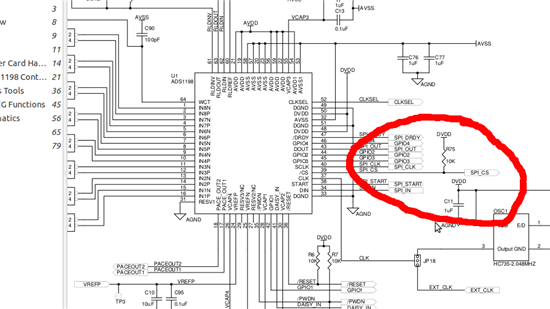 Changing from ADS1298 to ADS1198 - Data converters forum - Data converters - TI E2E support forums