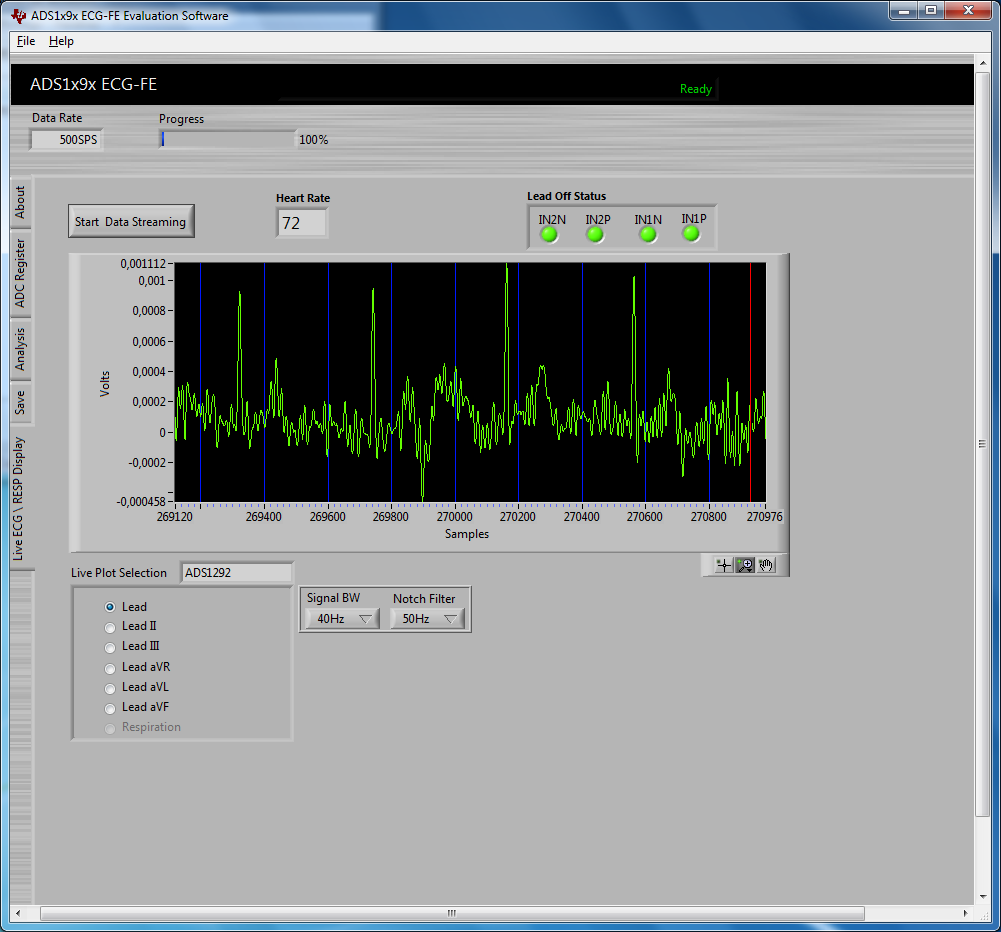 ADS1292: Why do I get bad ECGs with ADS1292ECG-FE GUI ? - Data converters forum - Data ...