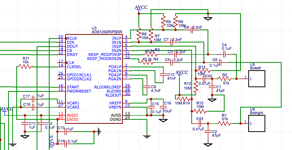 ADS1292R: Unstable ECG signals from person to person with ADS1292R - Data converters forum ...
