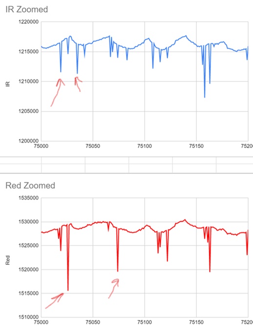 AFE4403: Negative spikes for PPG data from AFE - Data converters forum - Data converters - TI ...
