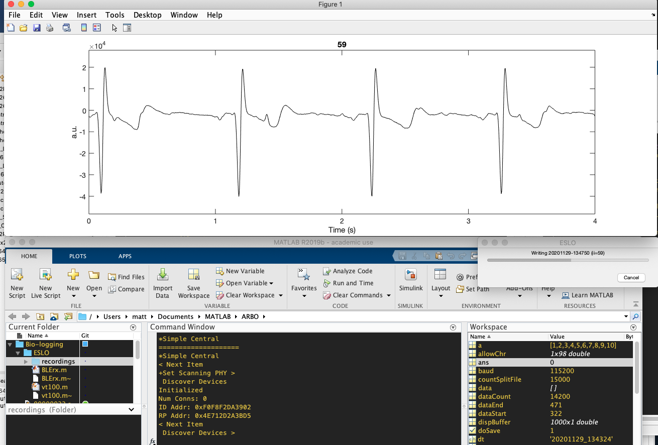 ADS1294: AC Coupling High-pass Filter Register Settings using RLDOUT - Data converters forum ...