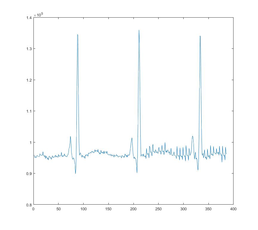 ADS1292R: Only noise when reading from channel 2 - Data converters forum - Data converters - TI ...