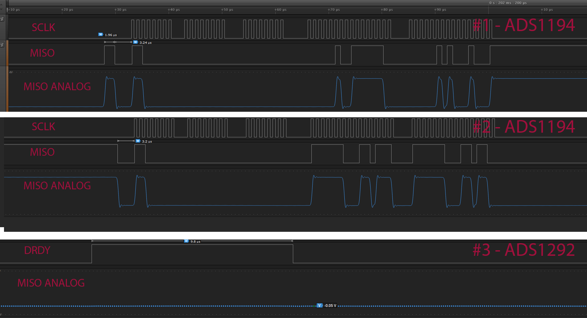 ADS1292: Difference with ADS1194 - MISO signal - Data converters forum - Data converters - TI ...