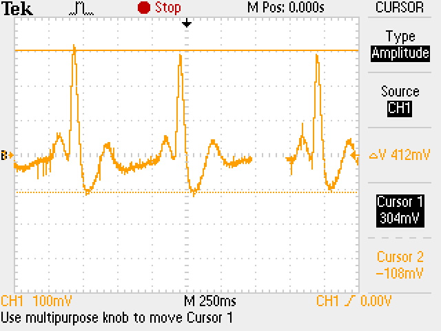 INA333 ECG application - Amplifiers forum - Amplifiers - TI E2E support ...